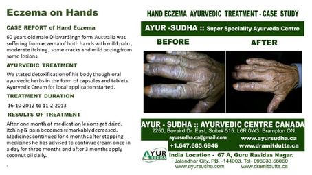 AYUR-SUDHA | Ayurvedic Clinic Brampton | Ayurvedic Doctor Brampton